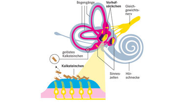 Warum lösen sich Otolithen?